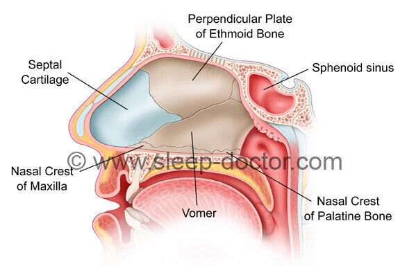 Septoplasty Sleep Doctor
